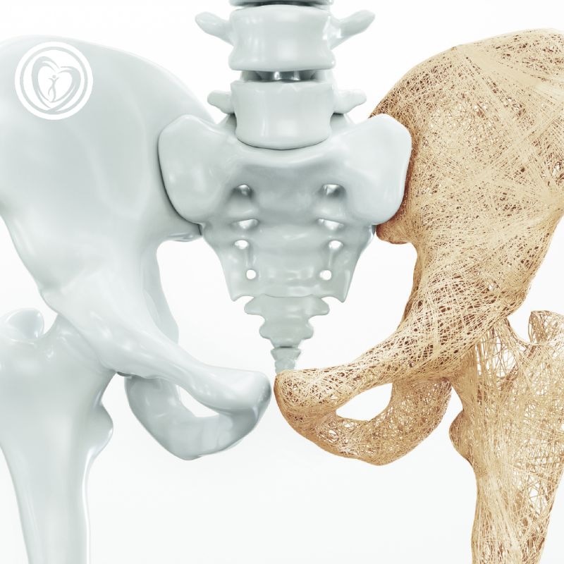 Osteoporose - Endocore
