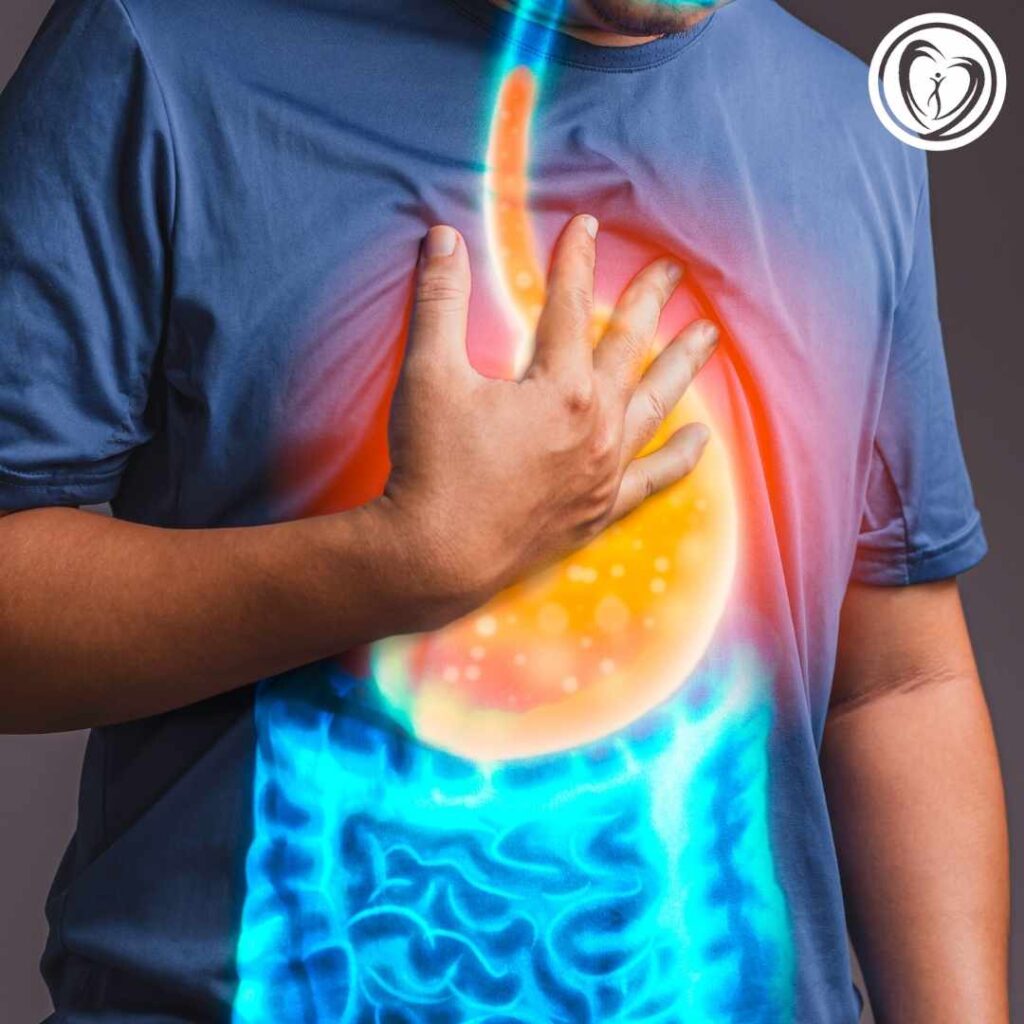 Doença do Refluxo Gastro-Esofágico - Endocore