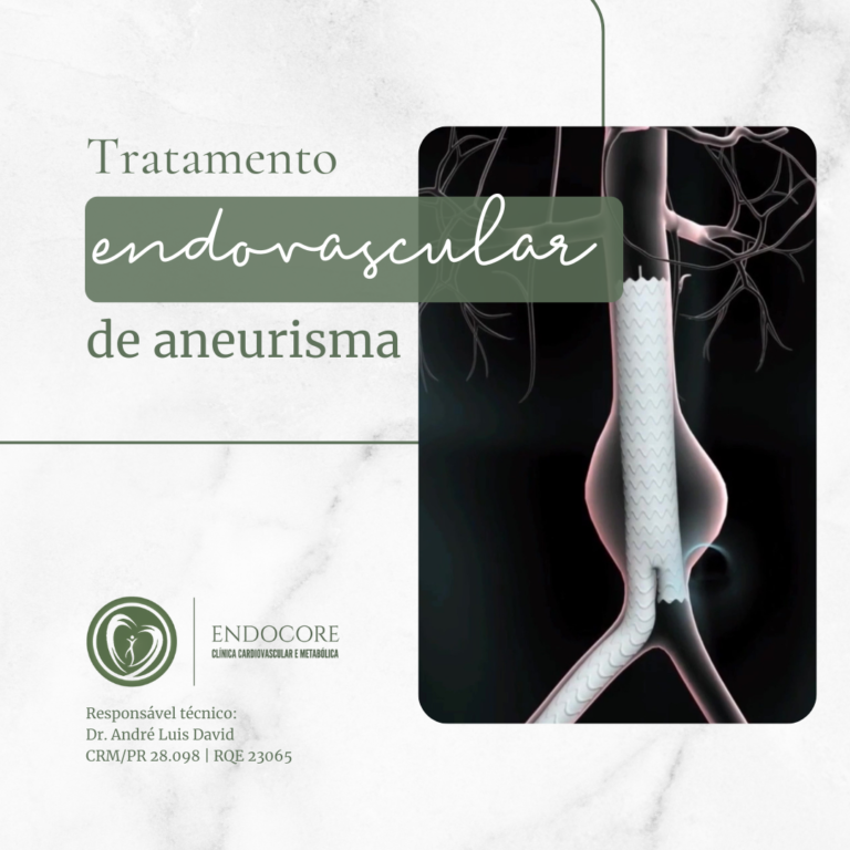 Tratamento ENDOVASCULAR de aneurisma - Endocore